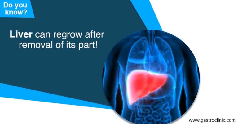 Liver Operation - Dr. Harsh J Shah