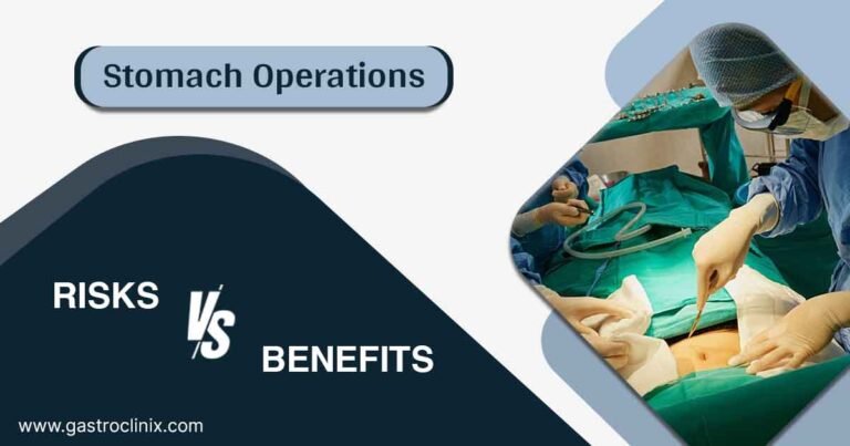 Stomach Surgery - Dr. Harsh J Shah