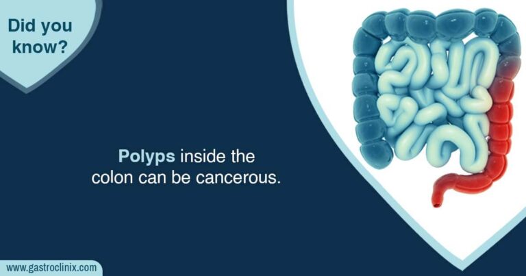 Colon Polyps / Unusual stomach pain? Don’t ignore it - Dr. Harsh J Shah