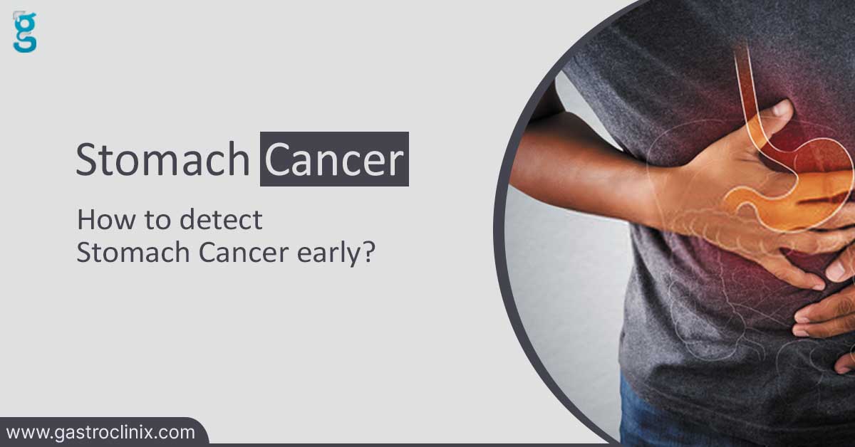 Stomach cancer - Dr. Harsh J Shah