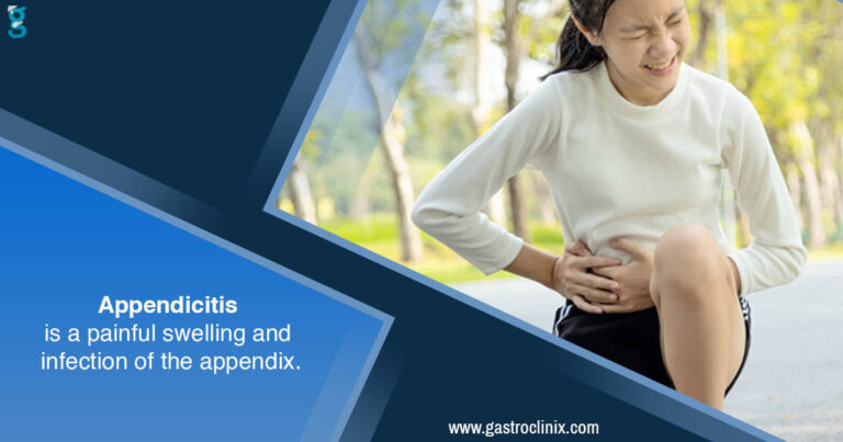 Appendicitis in Children - Dr. Harsh J Shah