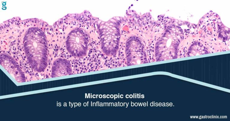 Microscopic Colitis - Dr. Harsh J Shah